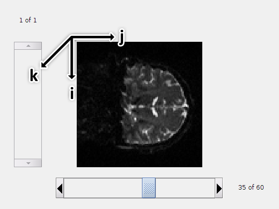 Working With Nifti 1 Files In Matlab